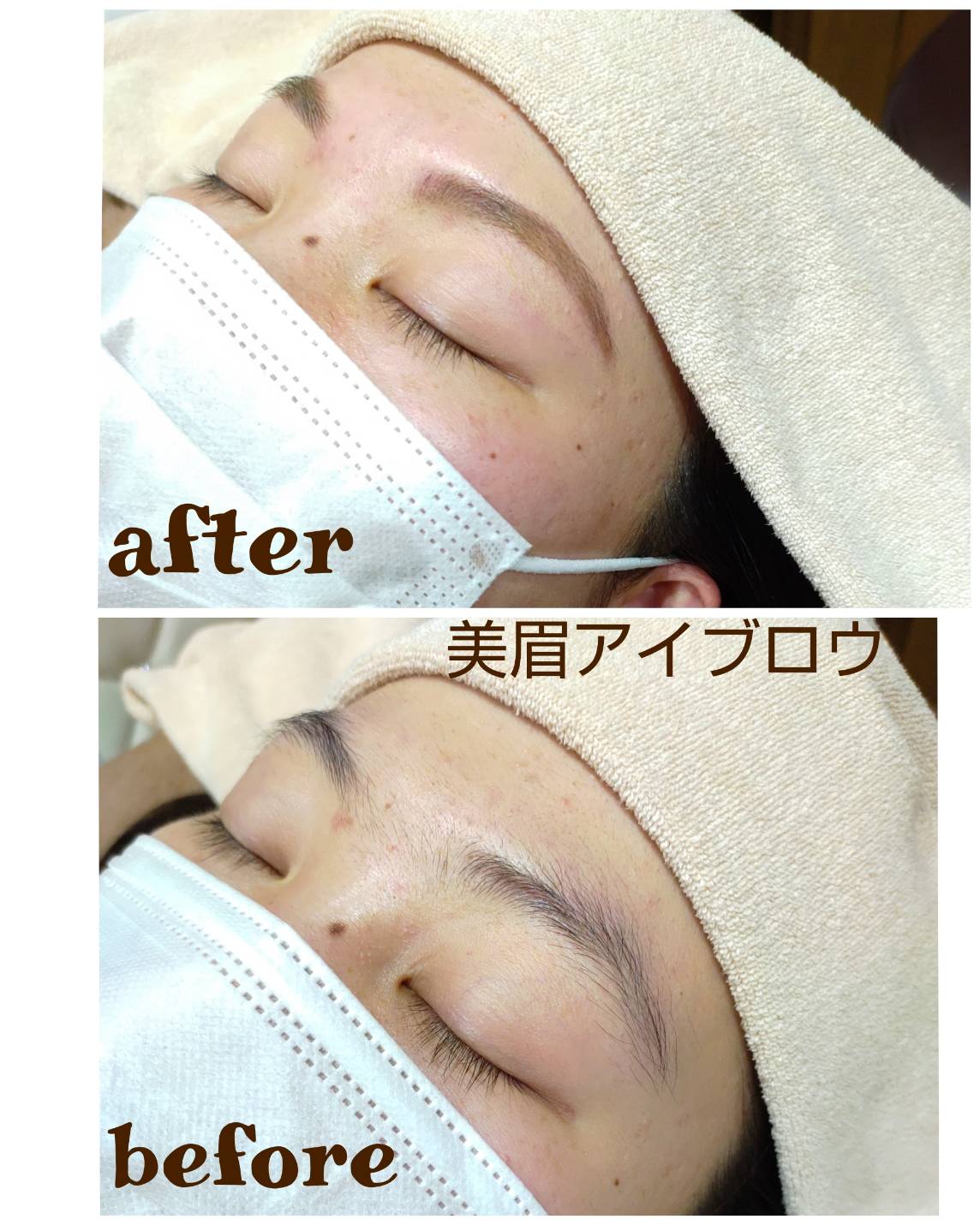 ビフォーアフター | Rilliant